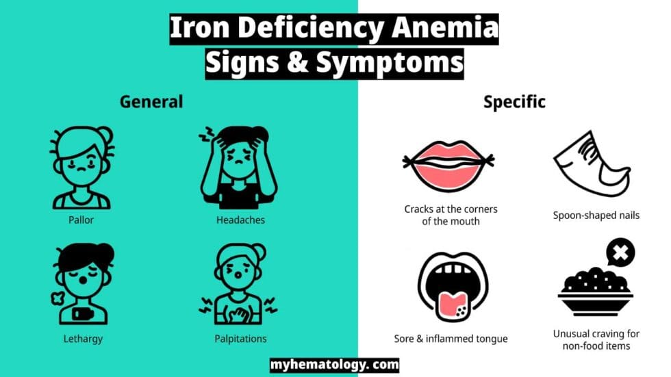 Iron Deficiency Anemia or IDA: Causes, Symptoms & Diagnosis