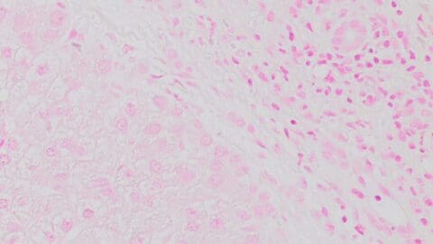 Perls’ / Prussian Blue Staining for Iron Stores Protocol