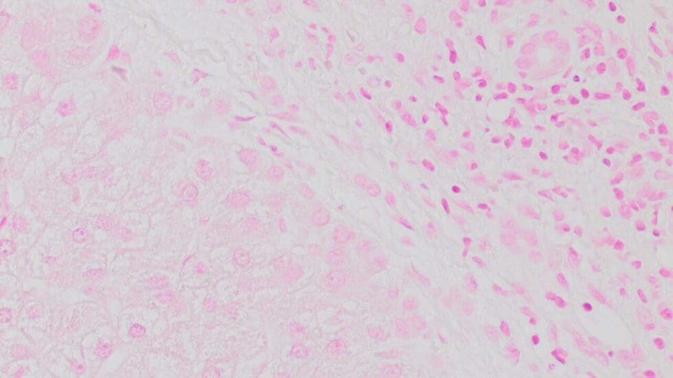 Perls’ / Prussian Blue Staining for Iron Stores Protocol