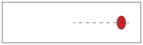Preparation of Peripheral Blood Smears | My Hematology