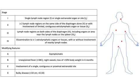 Hodgkin Lymphoma or Hodgkin's disease & Reed-Sternberg Cells