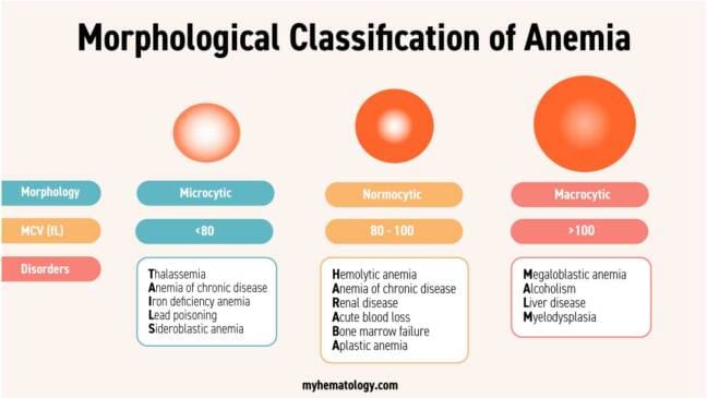 Anemia Types Causes Symptoms Treatment Diagnosis anemia-types-causes-symptoms-treatment-diagnosis