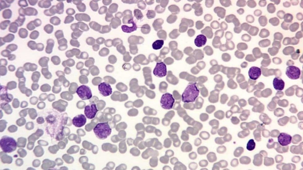 White Blood Cells (WBCs): Development, Types & Function