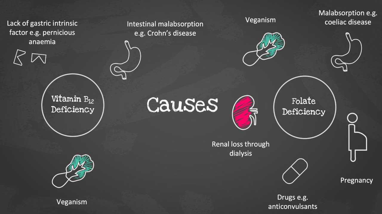 Anemia: Types, Causes, Symptoms, Treatment & Diagnosis