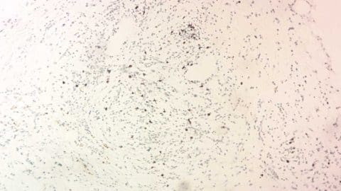 IHC - Immunohistochemistry Stain: Purpose, Principle & Protocol