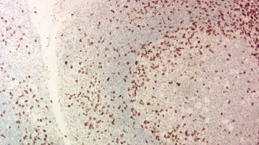 Immunohistochemistry (IHC) Stain: Purpose, Principle & Protocol