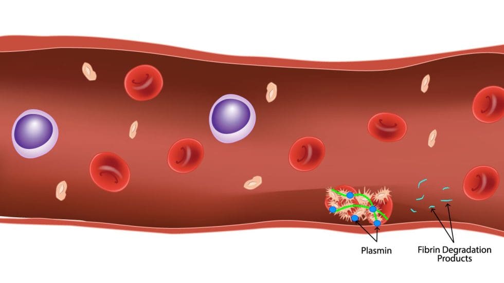 Hemostasis: Physiology, Stages, Key Players & Disorders