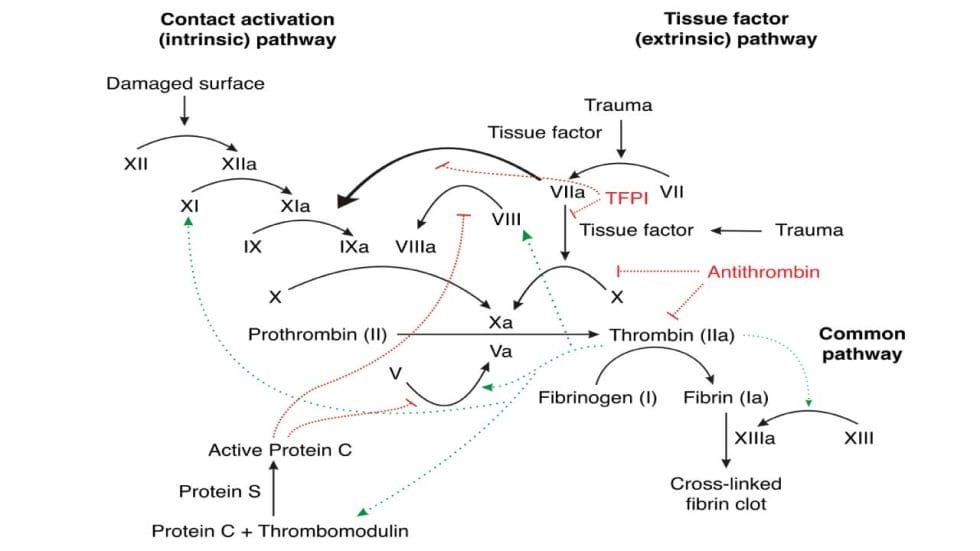 Factor V Leiden Thrombophilia: Causes, Symptoms & Treatment