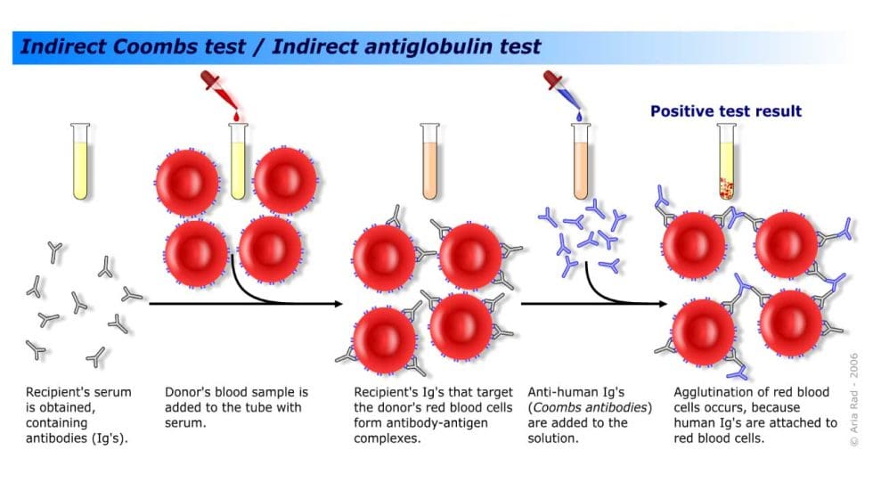 Indirect Antiglobulin (Coombs) Test (IAT): Principle & Protocol