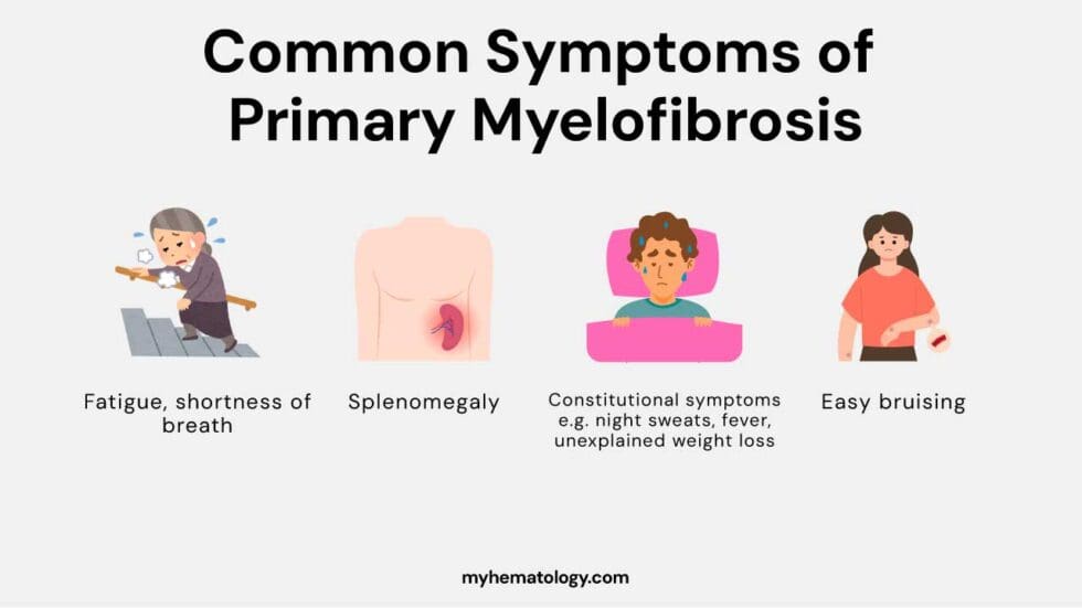 Primary Myelofibrosis: Causes, Symptoms & Diagnosis