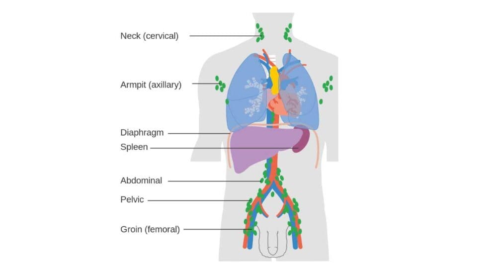Lymphoma Overview: Symptoms, Diagnosis & Treatment