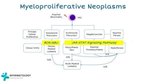Myeloproliferative Neoplasms - MPNs: Symptoms, Types & Diagnosis