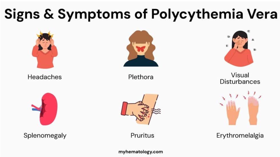 Polycythemia Vera: Causes, Pathophysiology, Symptoms & Treatment