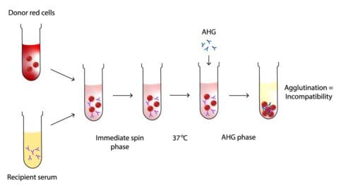 Serological Cross-matching: A Blood Compatibility Test