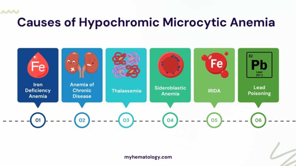 Microcytic Anemia: Causes of Hypochromia and Microcytosis