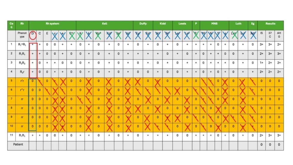 Antibody Identification Antigram Interpretation Method