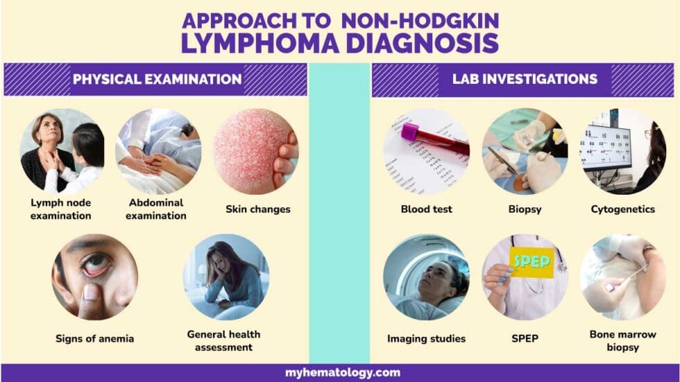 Non-Hodgkin Lymphoma: Symptoms, Diagnosis, Treatment & Subtypes
