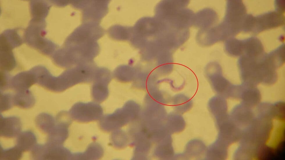 Preparation of Thick Blood Smears for Parasite Detection
