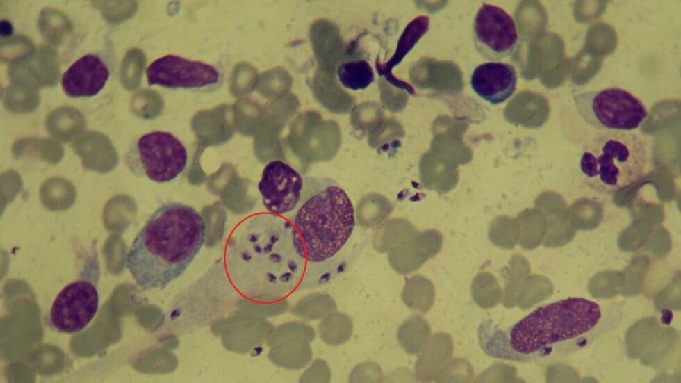 Preparation of Thick Blood Smears for Parasite Detection