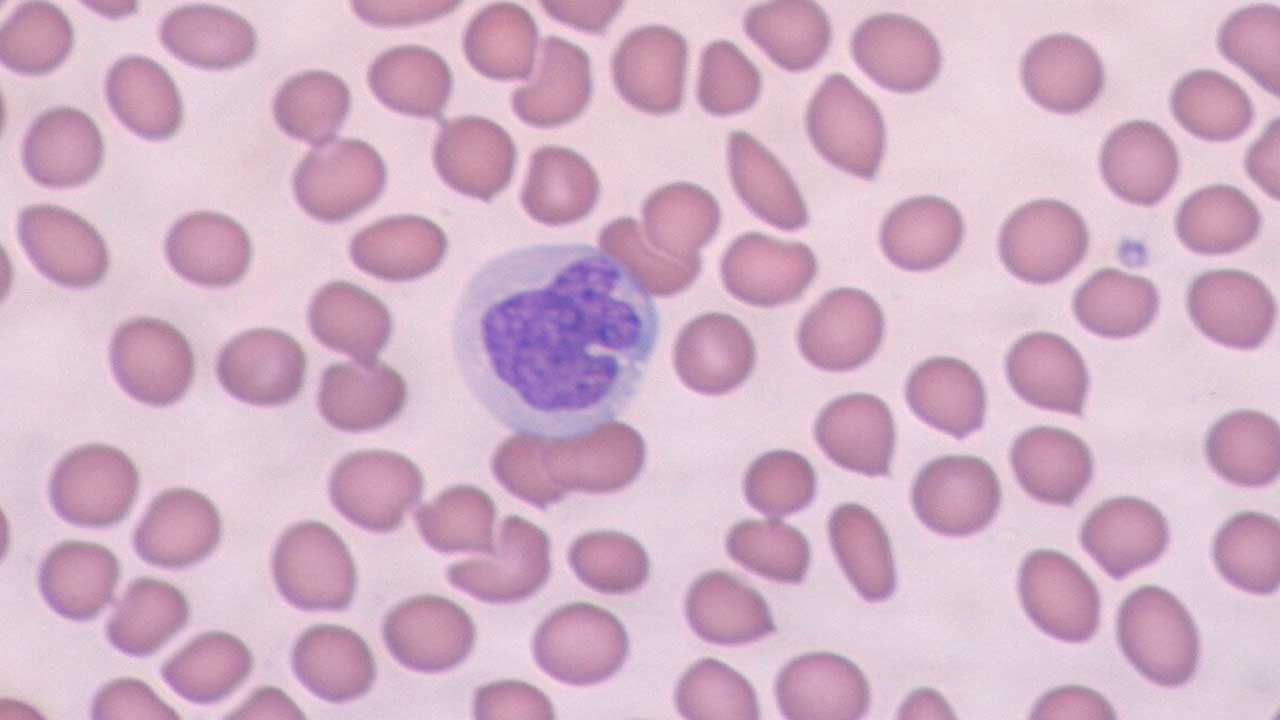 Monocytes Definition Function Causes Of High And Low Count