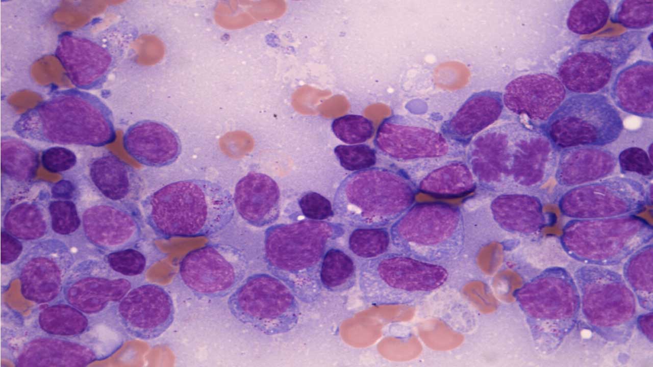 Natural Killer (NK) Cells: Function, Morphology & Identification