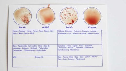 Blood Typing: Exploring Blood Type Tests and Beyond