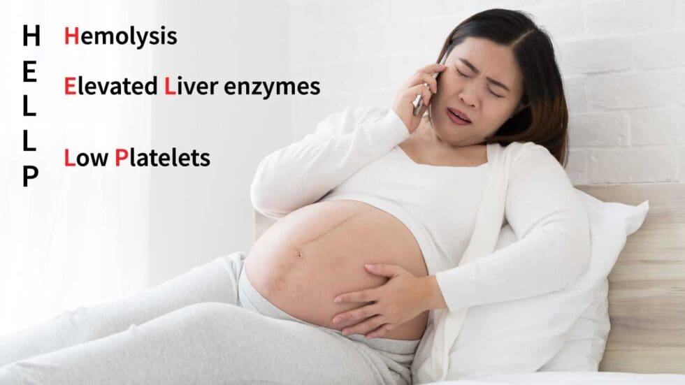 HELLP Syndrome: Pathophysiology, Symptoms & Treatment