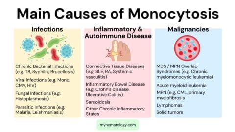 Understanding Monocytosis (High Monocytes): Causes and Symptoms