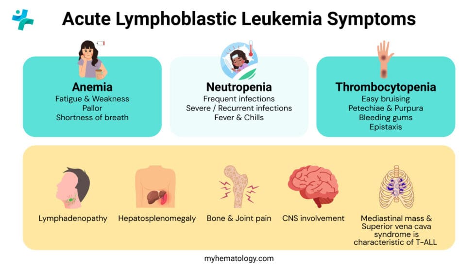 Acute Lymphoblastic Leukemia or ALL: Causes, Symptoms & Treatment