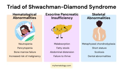 Shwachman-Diamond Syndrome or SDS: Causes, Diagnosis & Treatment
